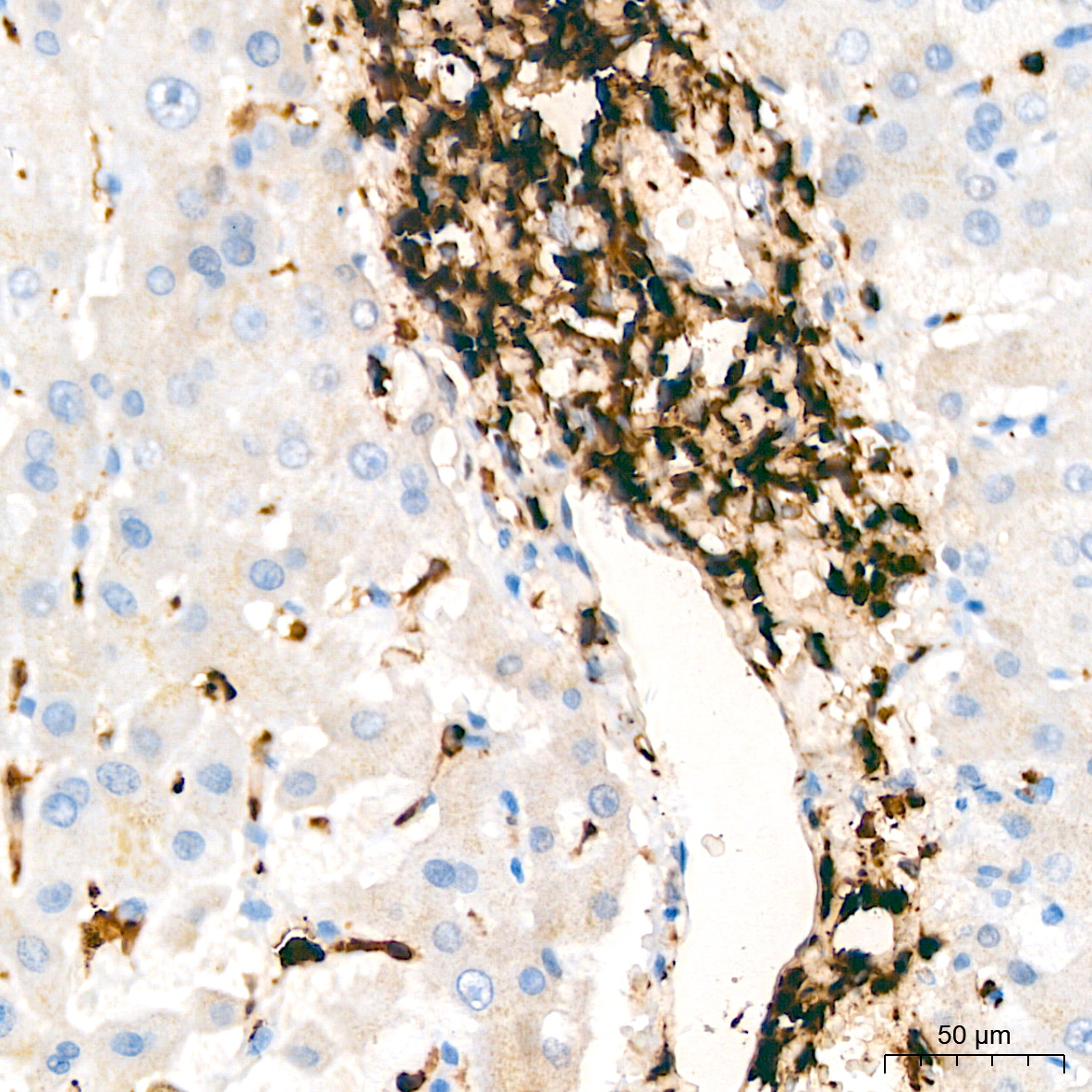 FSP1/S100A4 Rabbit mAb-단일클론항체(mAb) - ABclonal