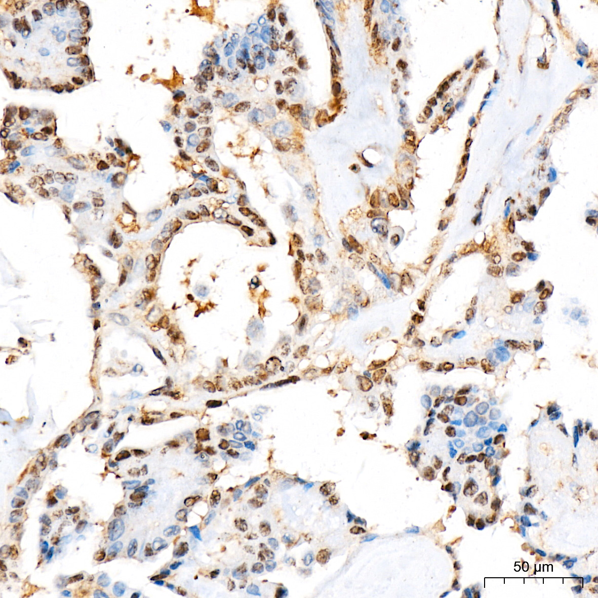 단일클론항체(mAb) - ABclonal