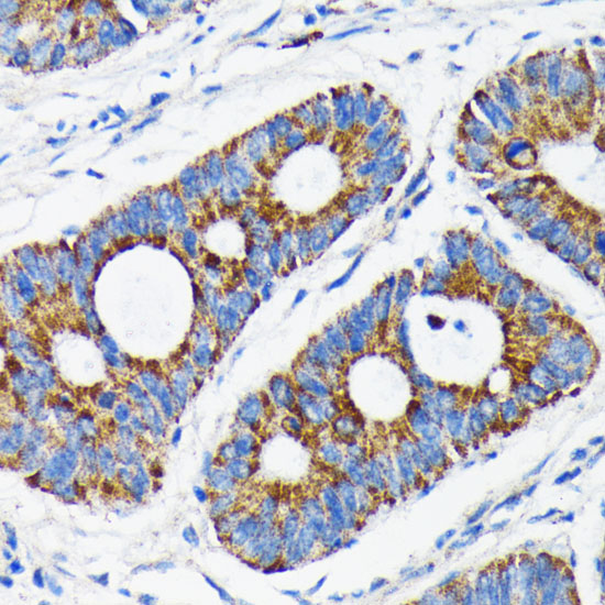 Bax Rabbit mAb-Monoclonal Antibodies - ABclonal