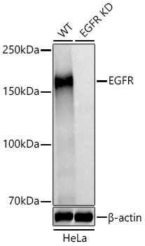 [KD Validated] EGFR Rabbit pAb-Polyclonal Antibodies - ABclonal