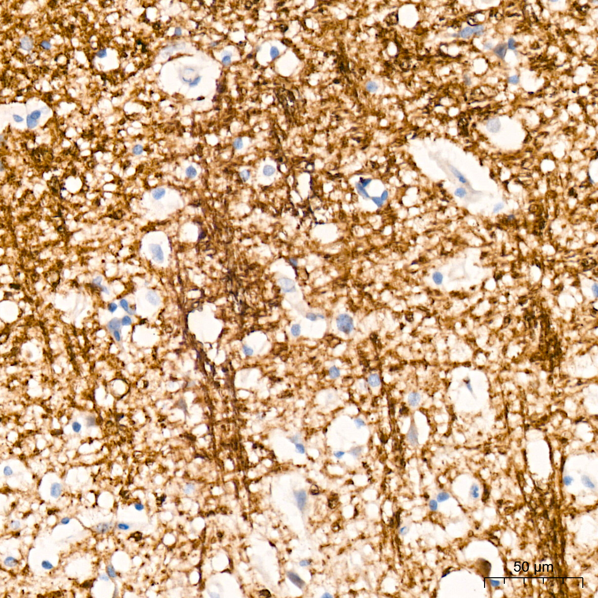 MAP2 Rabbit mAb-단일클론항체(mAb) - [30% 할인중] - ABclonal