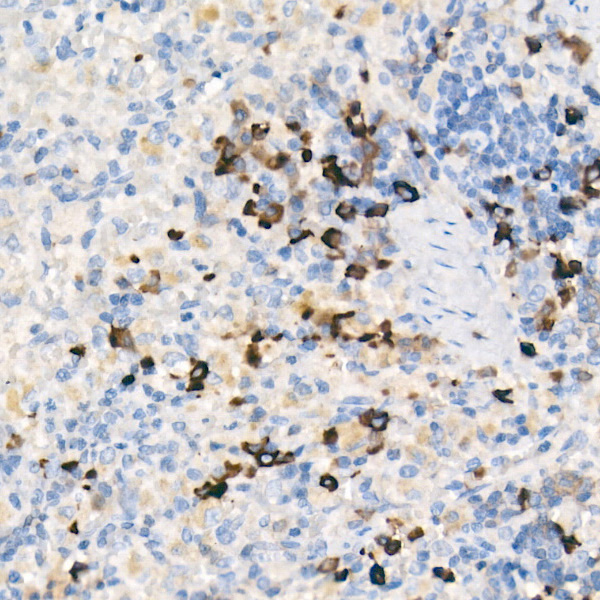 Mouse IgM Rabbit mAb-단일클론항체(mAb) - ABclonal