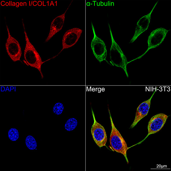 Collagen I/COL1A1 Rabbit mAb-Monoclonal Antibodies - ABclonal