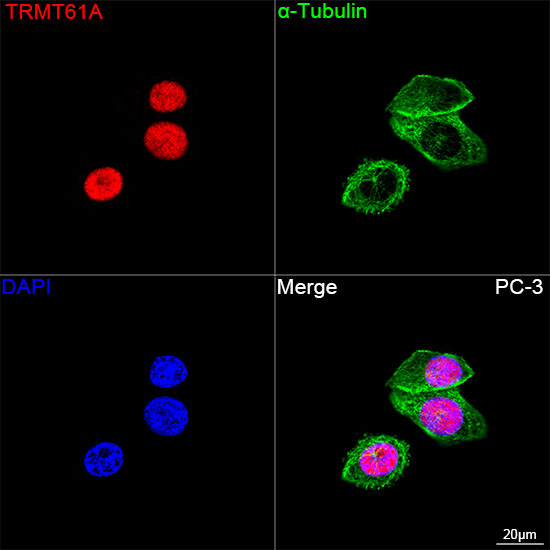 TRMT61A Rabbit mAb-단일클론항체(mAb) - ABclonal