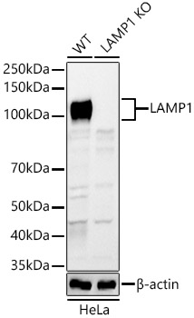 LAMP1 Rabbit pAb-다중클론항체(pAb) - ABclonal