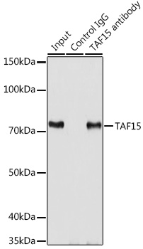 TAF15 Rabbit pAb-다중클론항체(pAb) - ABclonal