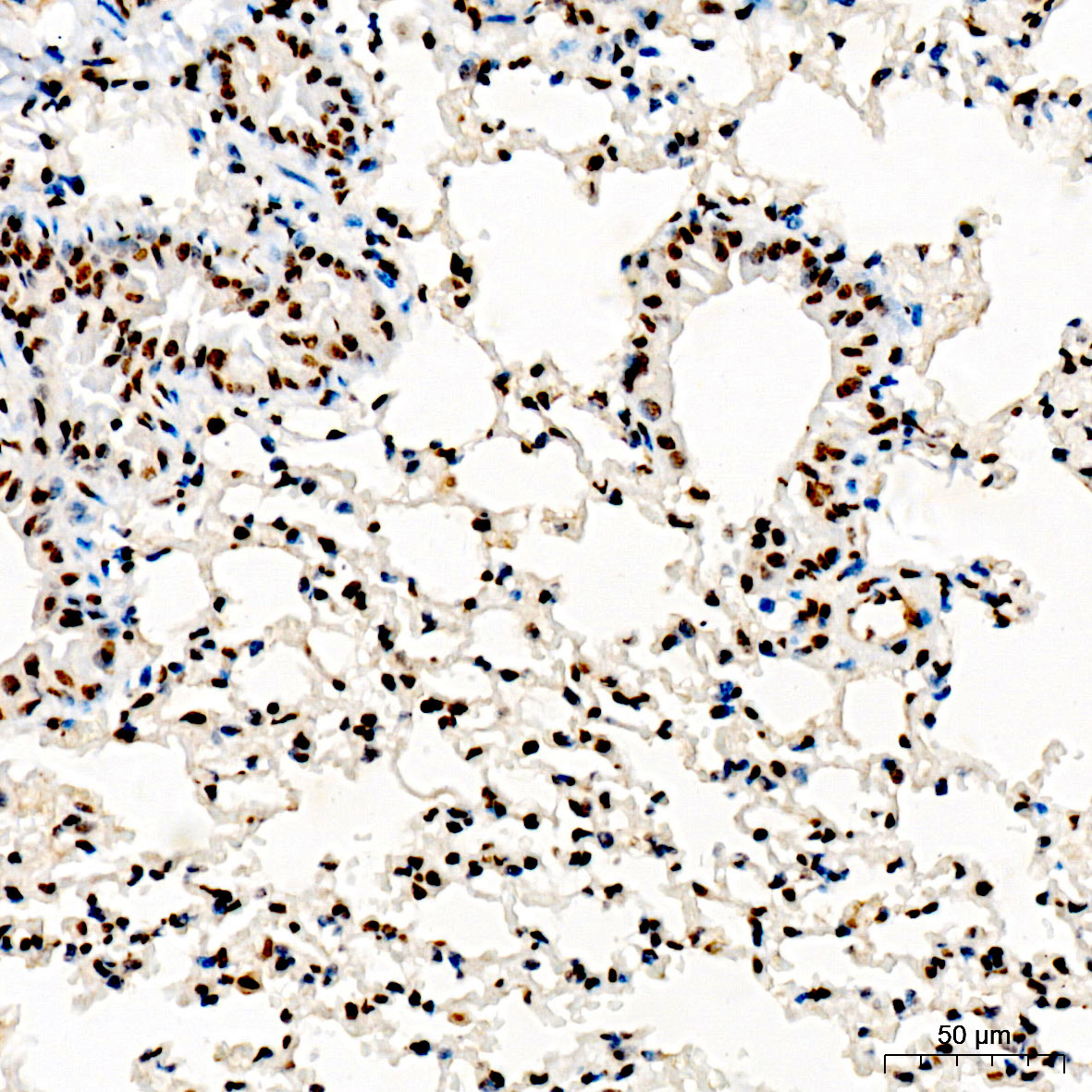 Epigenetic Modifications - ABclonal