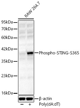 Phospho-STING-S365 Rabbit pAb-Phospho-specific Antibodies - ABclonal