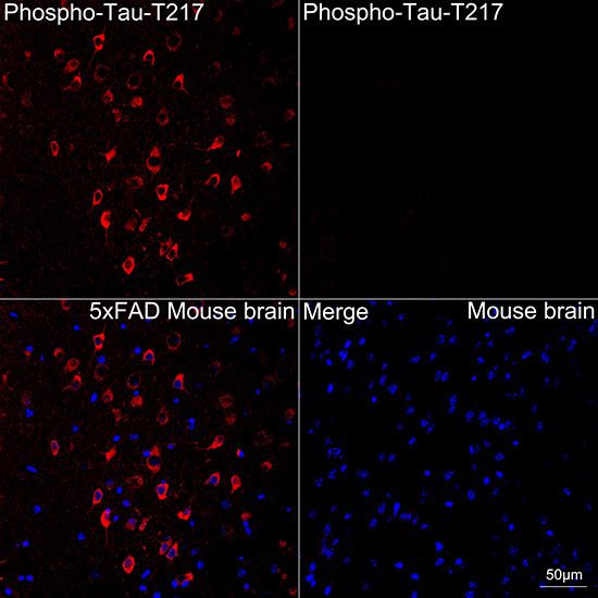 Phospho-Tau-T217 Rabbit mAb-Phospho-specific Antibodies - ABclonal