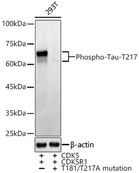 Phospho-Tau-T217 Rabbit mAb-Phospho-specific Antibodies - ABclonal