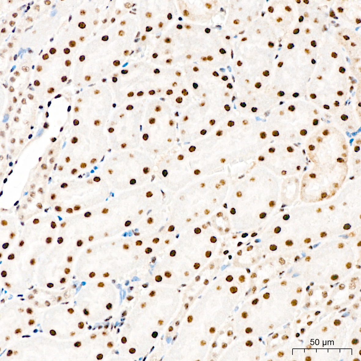 Phospho-PERK-T982 Rabbit mAb-인산화 특이적 항체 - ABclonal